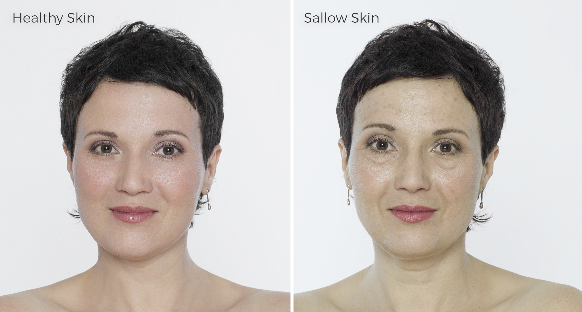 Sallow Skin What Is It Do You Have It And How To Treat It