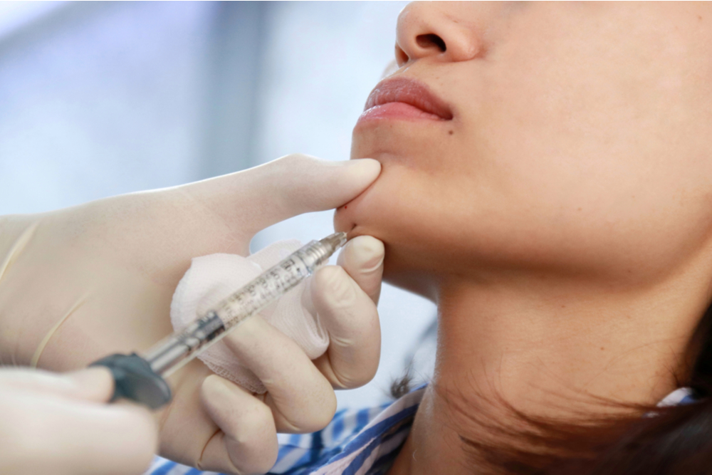 Chin Fillers: Candidates, Results, Side Effects, Cost, and More